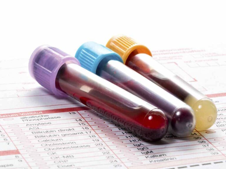Is Workplace Drug and Alcohol Testing Legal in Australia? | Lyons Law Group